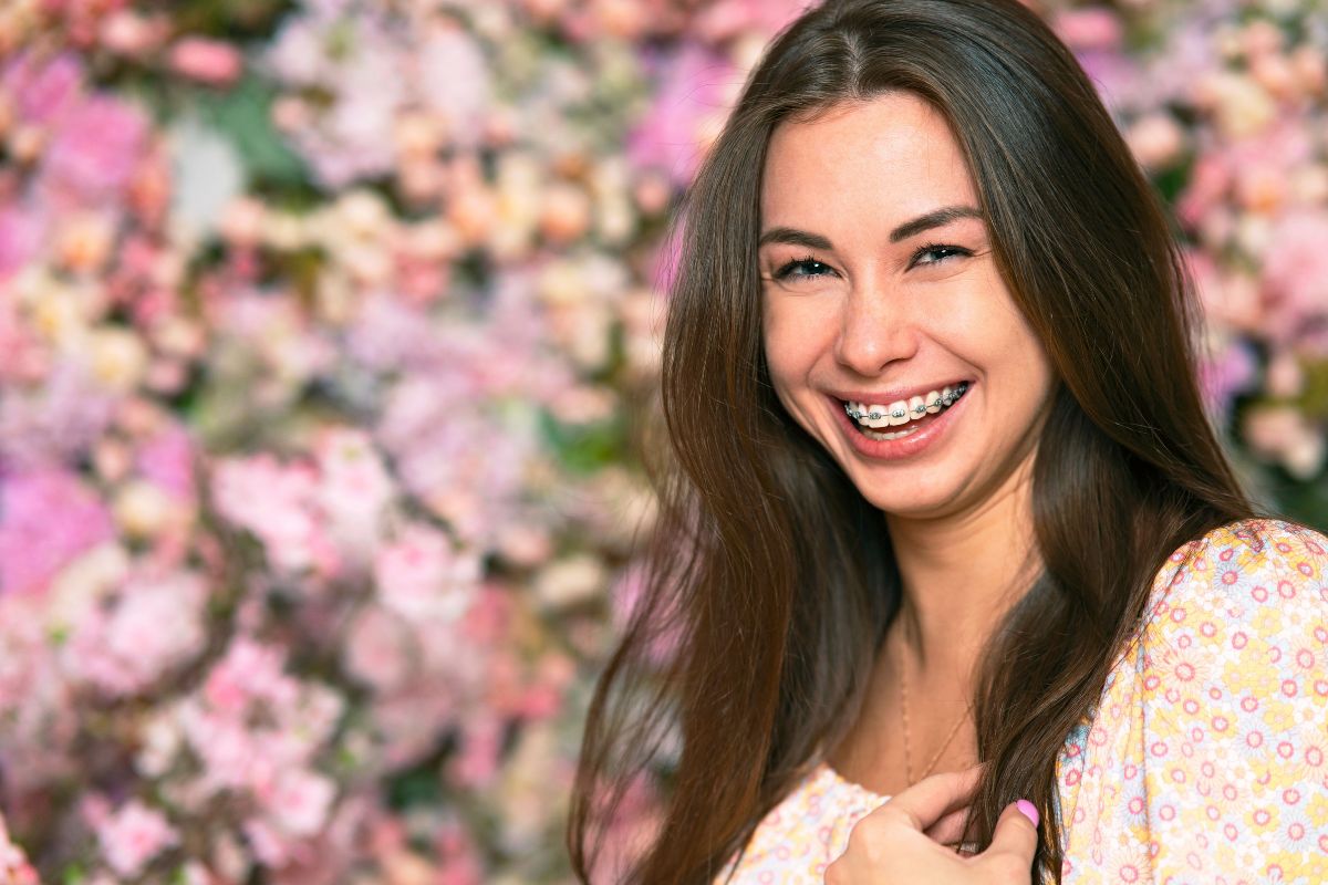 Spring Braces Colors